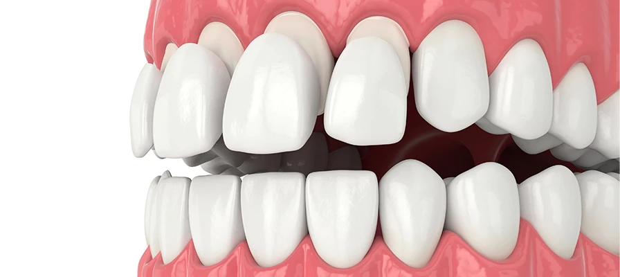 Dentist In Margate & Pompano, Florida | Vital Dental Center